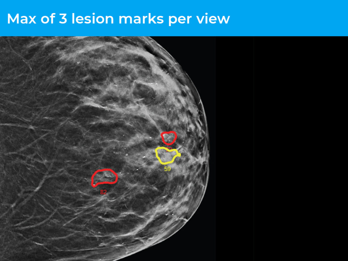 Improve Workstation Readability with ProFound AI Detection v3 Service ...