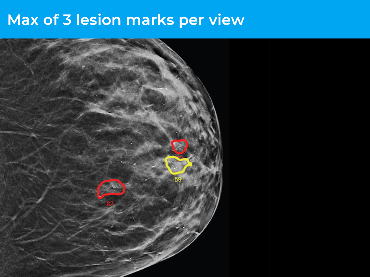 Improve Workstation Readability with ProFound AI Detection v3 Service ...