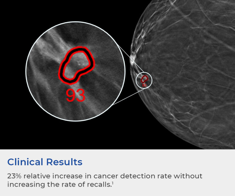 Improve Workstation Readability with ProFound AI Detection v3 Service ...