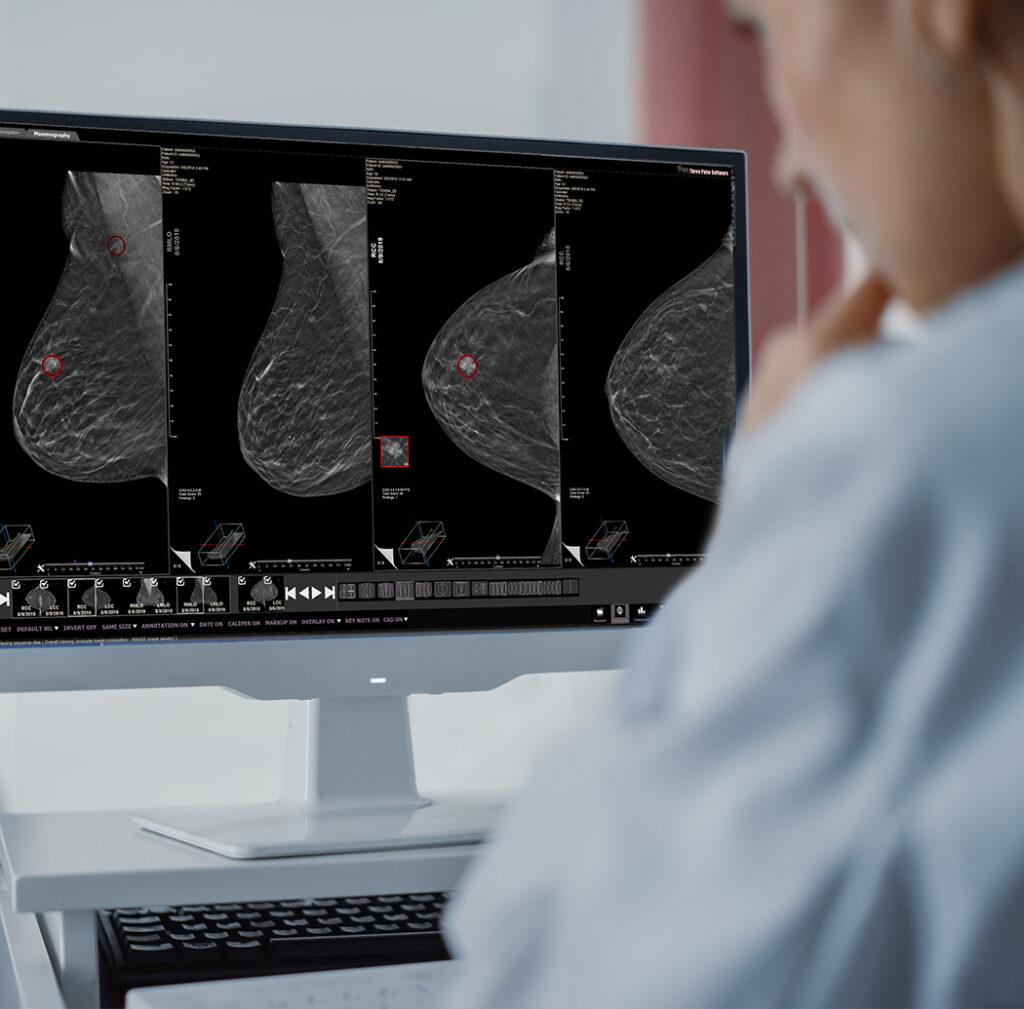 AI Breast Cancer Detection | iCAD