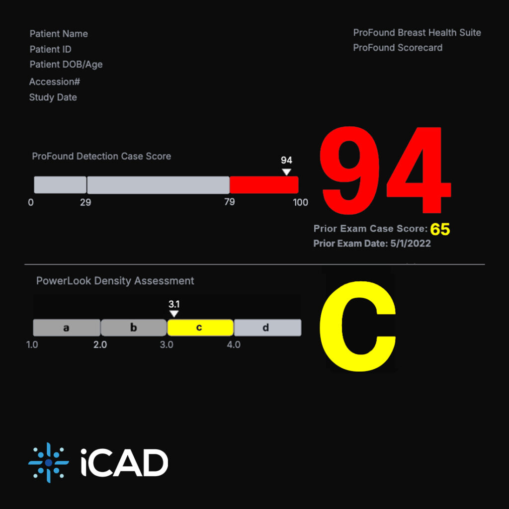 AI Breast Cancer Detection | iCAD